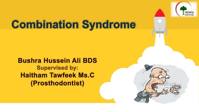 Combination syndrome | PPTX