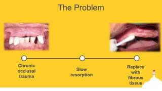 Combination syndrome | PPTX