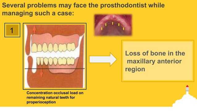 Combination syndrome | PPTX