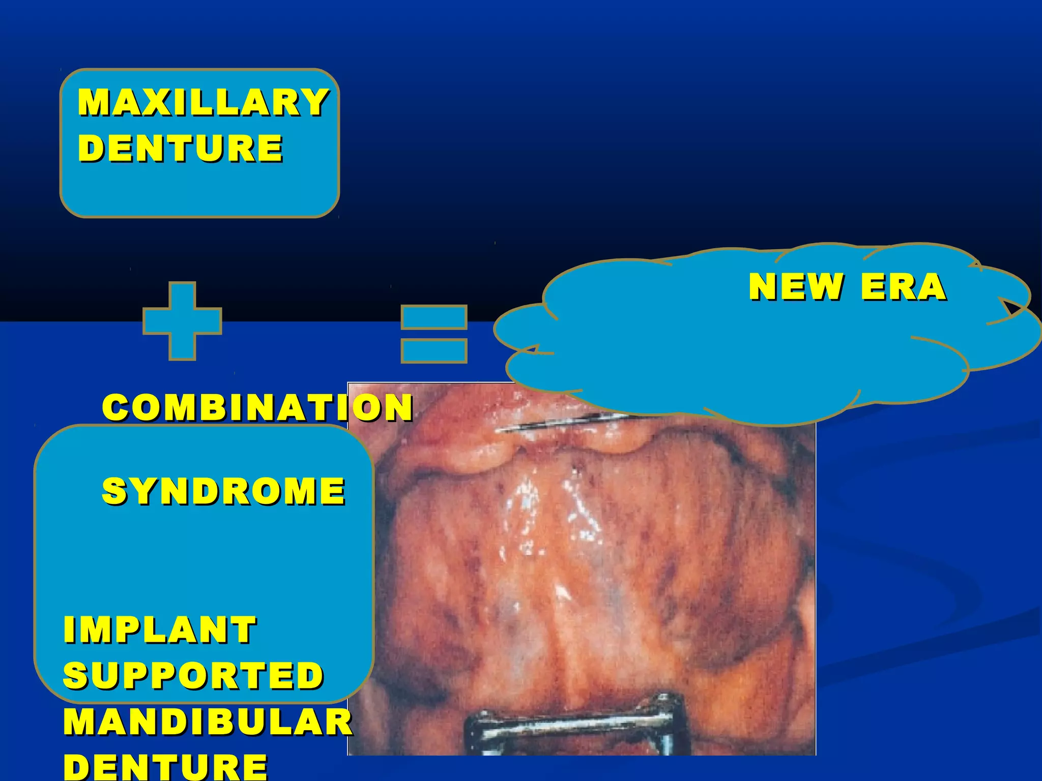 Combination syndrome revised | PPT