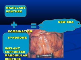 Combination syndrome revised | PPT