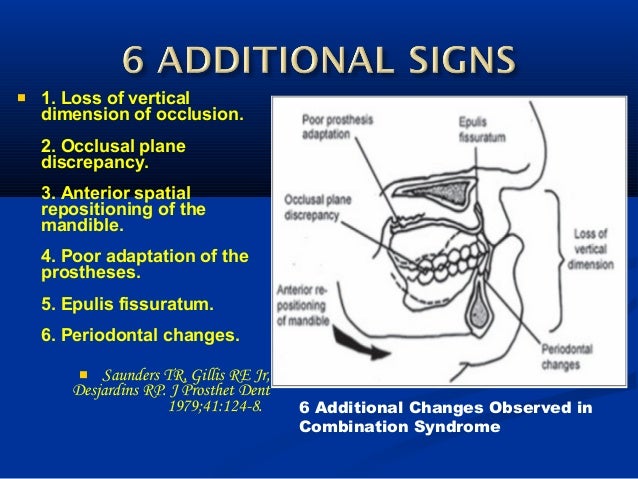 Combination syndrome revised