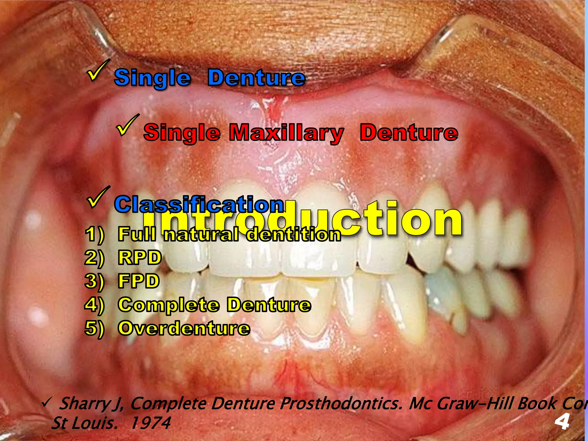 Combination syndrome revisited | PPTX