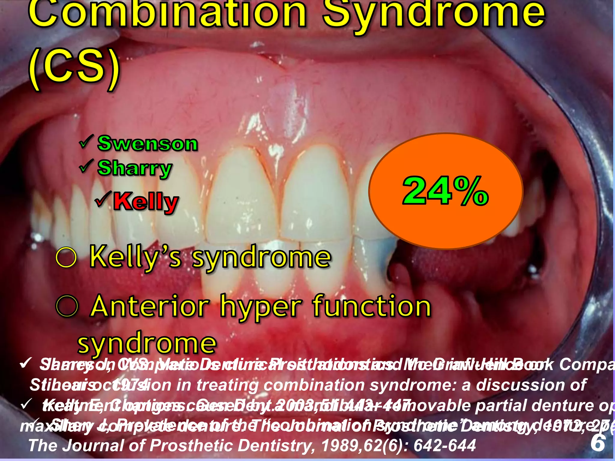 Combination syndrome revisited | PPTX