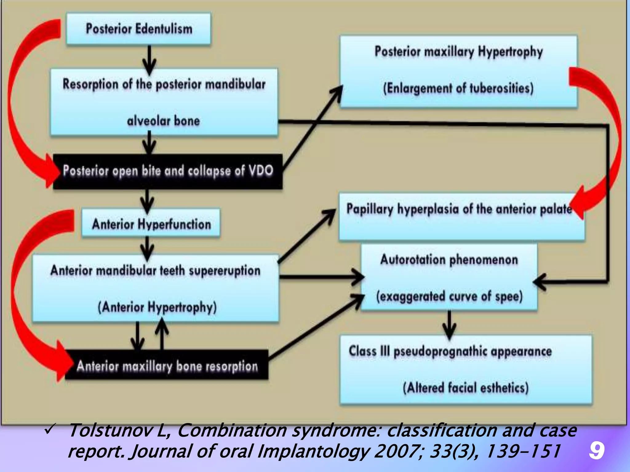 Combination syndrome revisited | PPTX