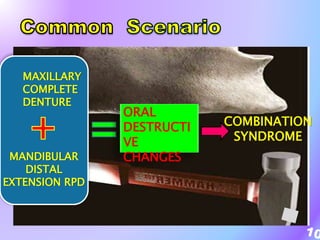Combination syndrome revisited | PPTX