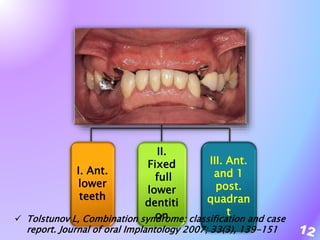 Combination syndrome revisited | PPTX