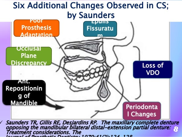 Combination syndrome revisited