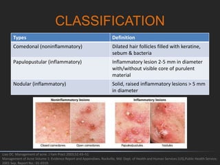 Combination therapy for recurrent acne | PPTX