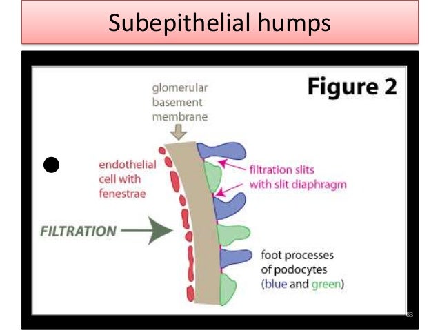 Renal Pathology