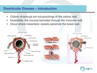 Combined 03 clinical training--pathology benign_diverticular disease ...