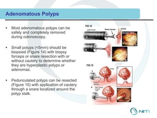 Combined 08 clinical training--pathology pre-malignant_colorectal ...
