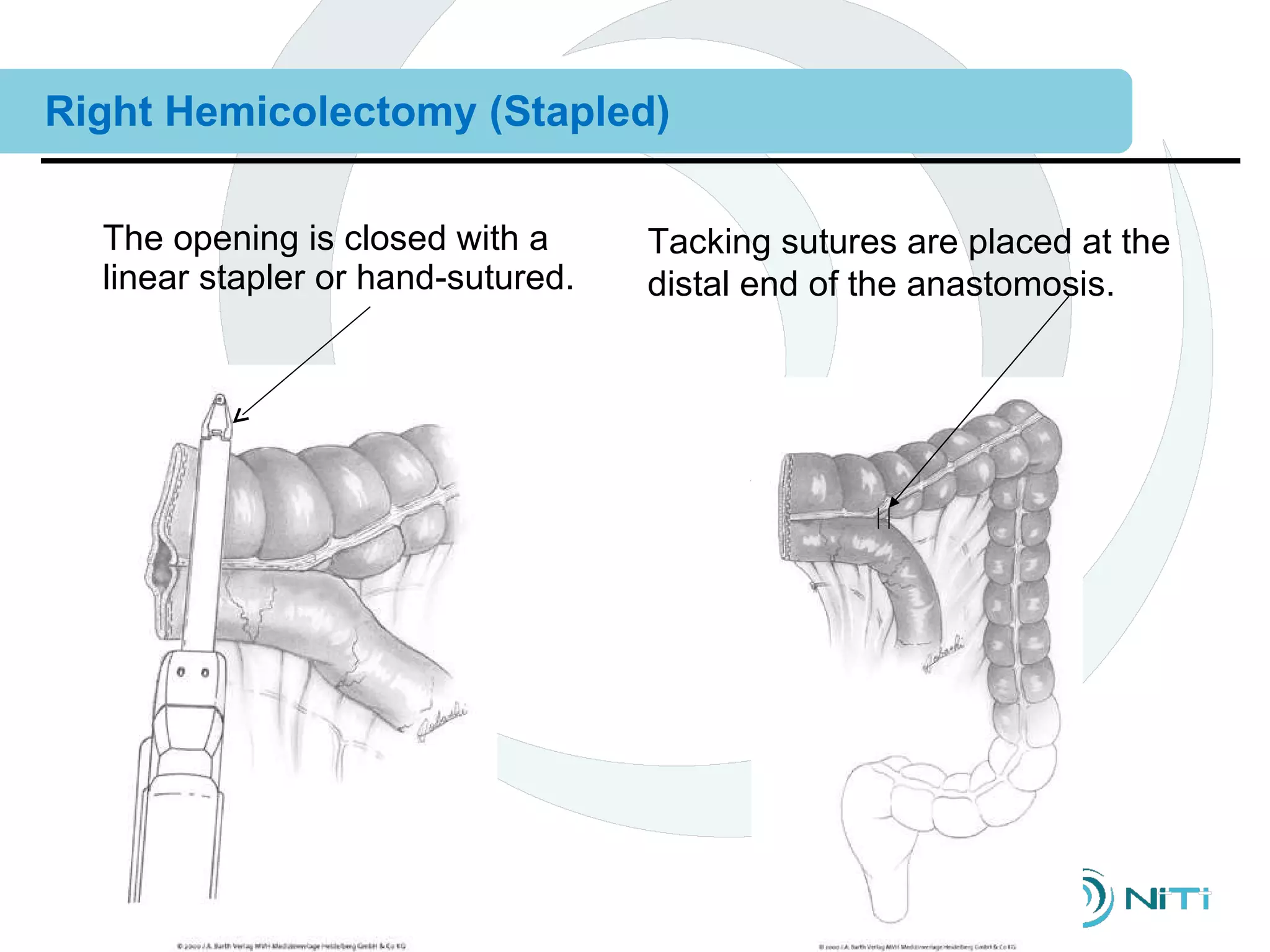 Combined 12 clinical training--surgical procedures | PPT