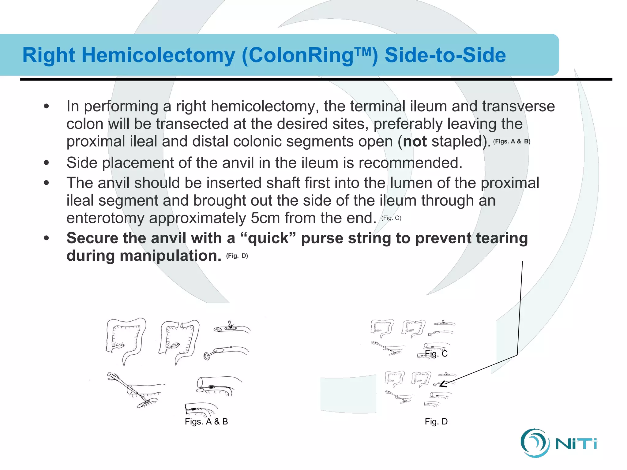 Combined 12 clinical training--surgical procedures | PPT