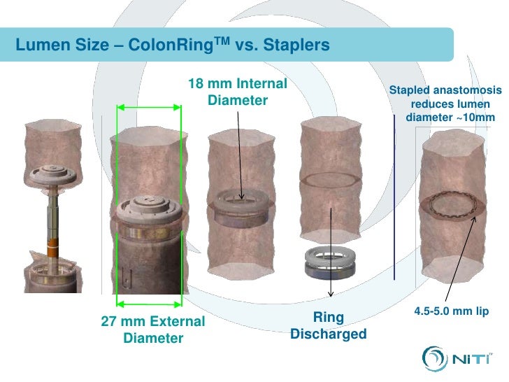 Combined 14 clinical training--compression anastomosis