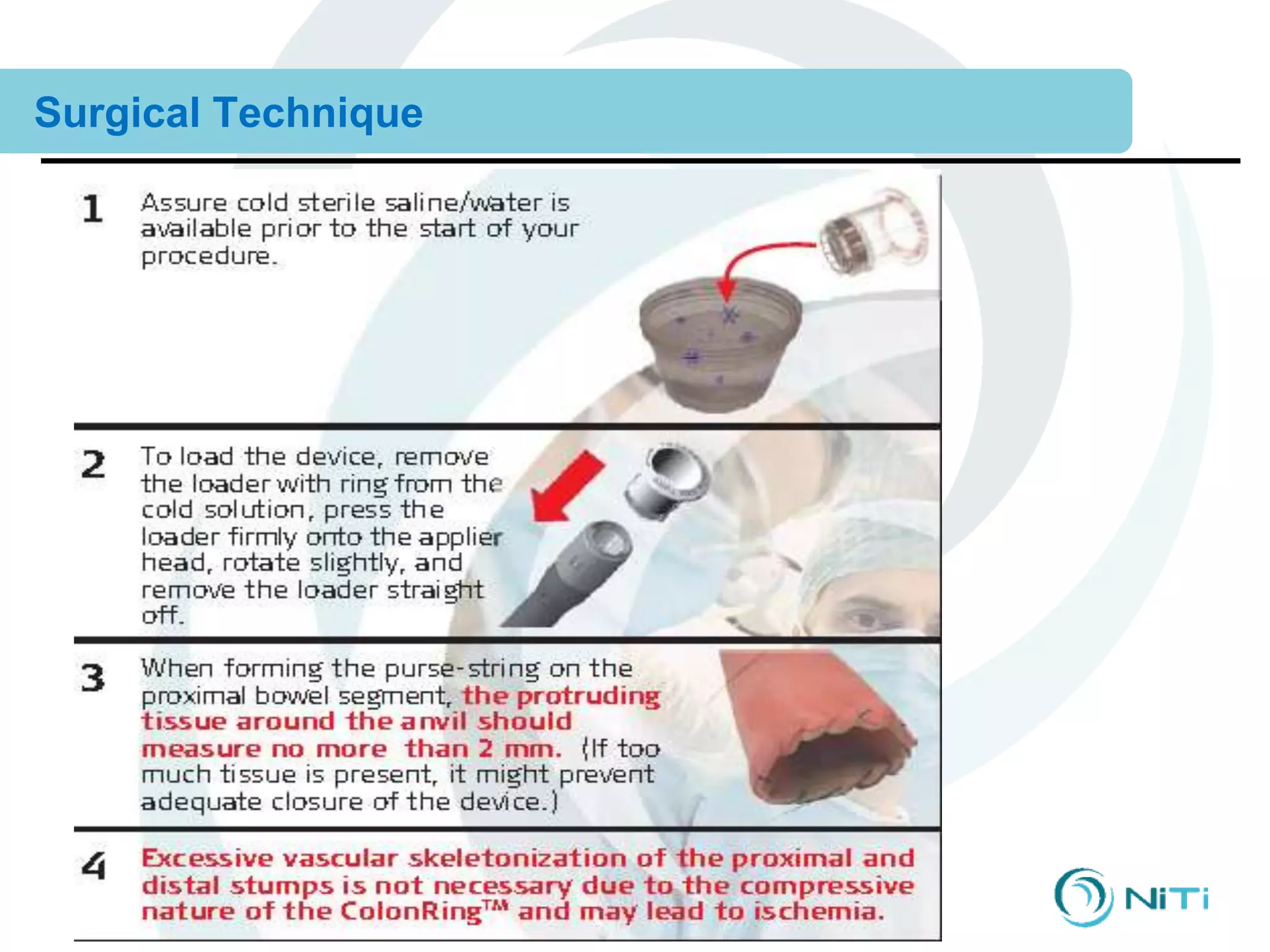 Combined 16 clinical training--use of colon_ring | PPTX