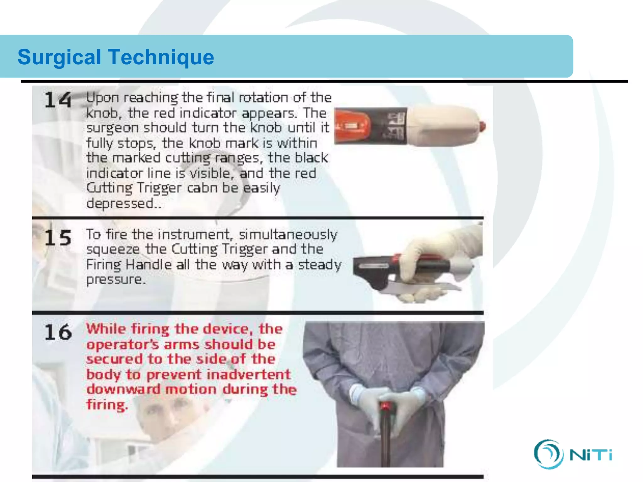 Combined 16 clinical training--use of colon_ring | PPTX