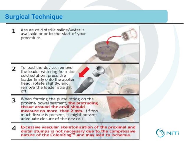 Combined 16 clinical training--use of colon_ring | PPTX | Surgery ...