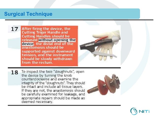 Combined 16 clinical training--use of colon_ring | PPTX | Surgery ...