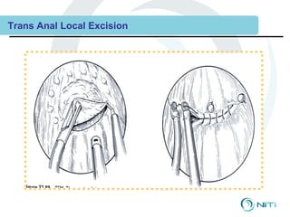 Combined 18 clinical training--rectal surgical principles | PPTX