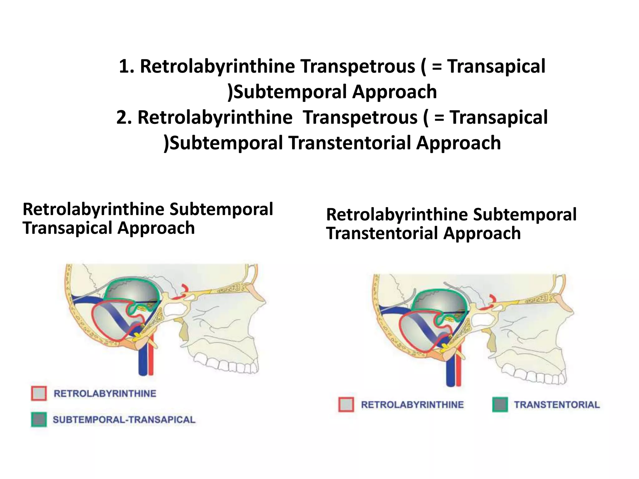 Combined approaches of skull base 360° | PPTX