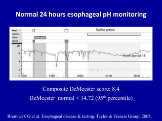 Combined esophageal pH-Multiple Intraluminal Impedence | PPTX