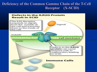 Combined immunodeficiency | PPT