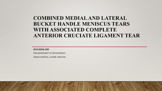 Combined medial and lateral bucket handle meniscus tears_023024.pptx