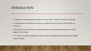 Combined medial and lateral bucket handle meniscus tears_023024.pptx