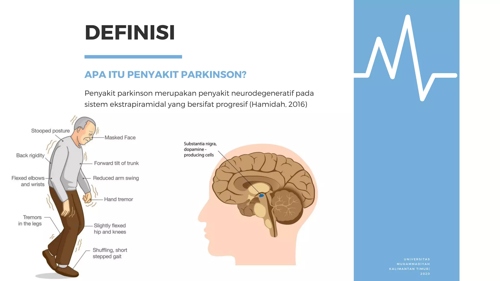 PPT Penyakit Parkinson + Script For Audio | PDF