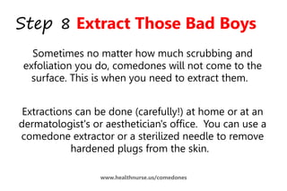 Comedonal Acne Cure in 10 Easy Steps! | PPT