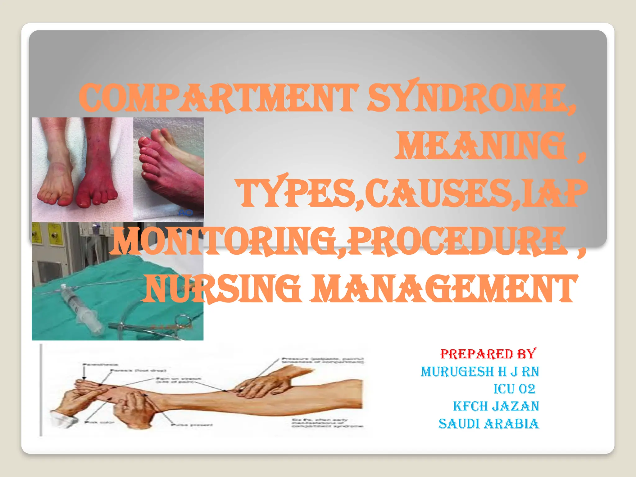 Compartment syndrome, meaning , types, causes , nursing management ...