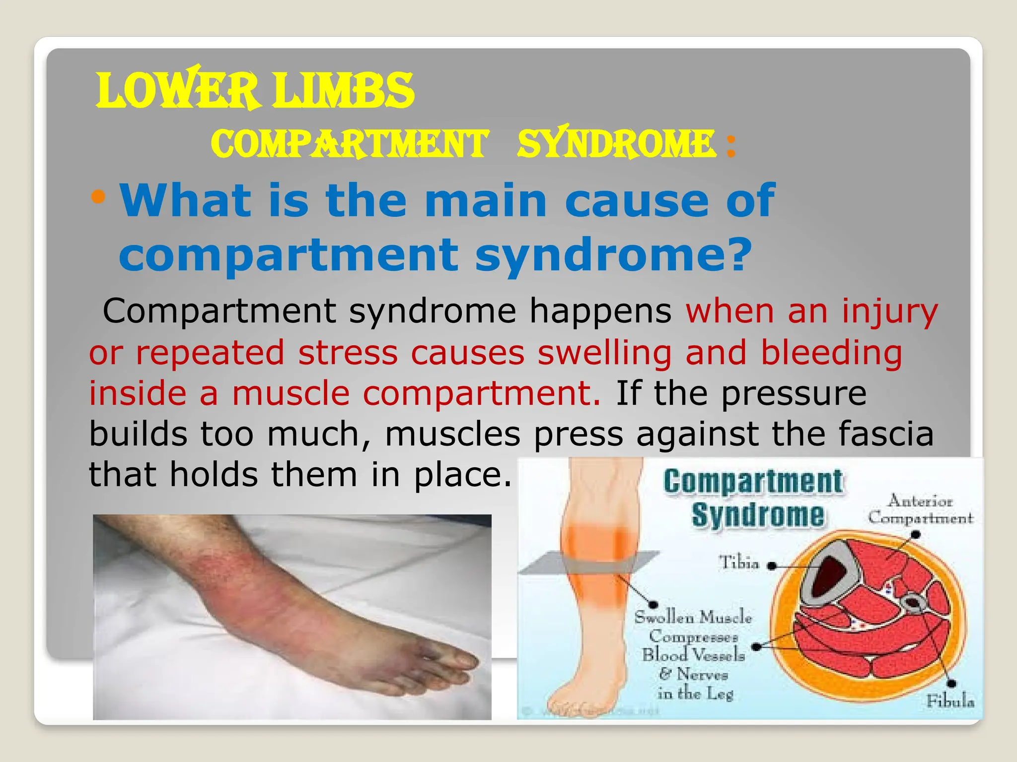 Compartment syndrome, meaning , types, causes , nursing management , murugesh.pptx