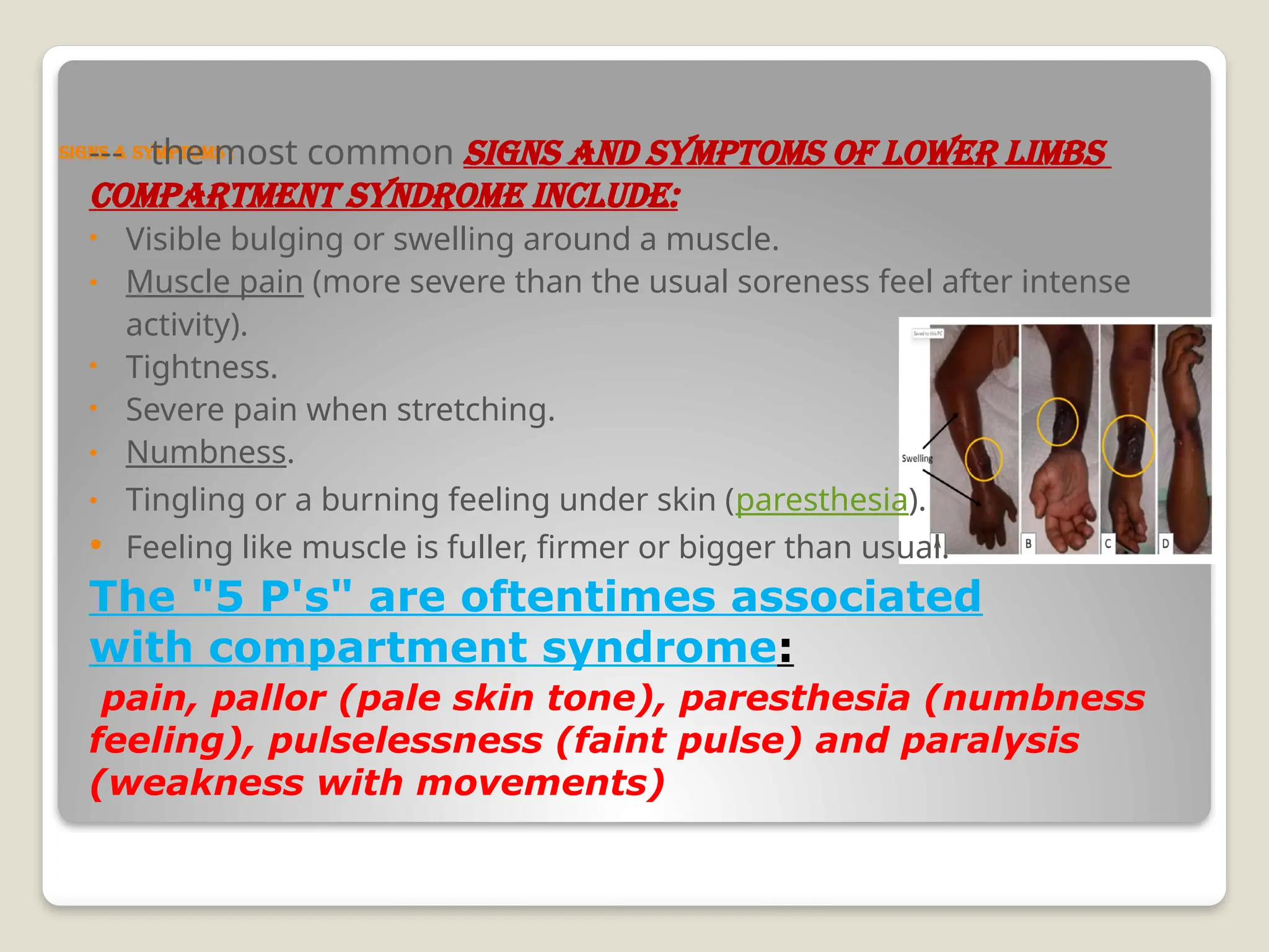 Compartment syndrome, meaning , types, causes , nursing management , murugesh.pptx