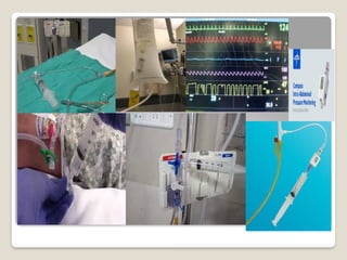 Compartment syndrome, meaning , types, causes , nursing management ...