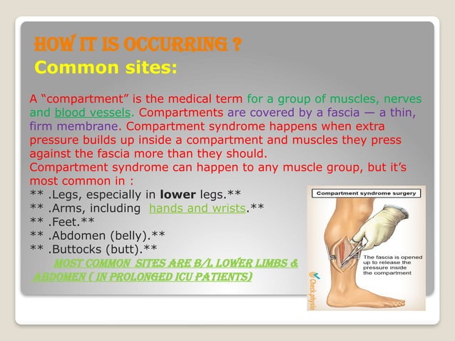 Compartment syndrome, meaning , types, causes , nursing management ...