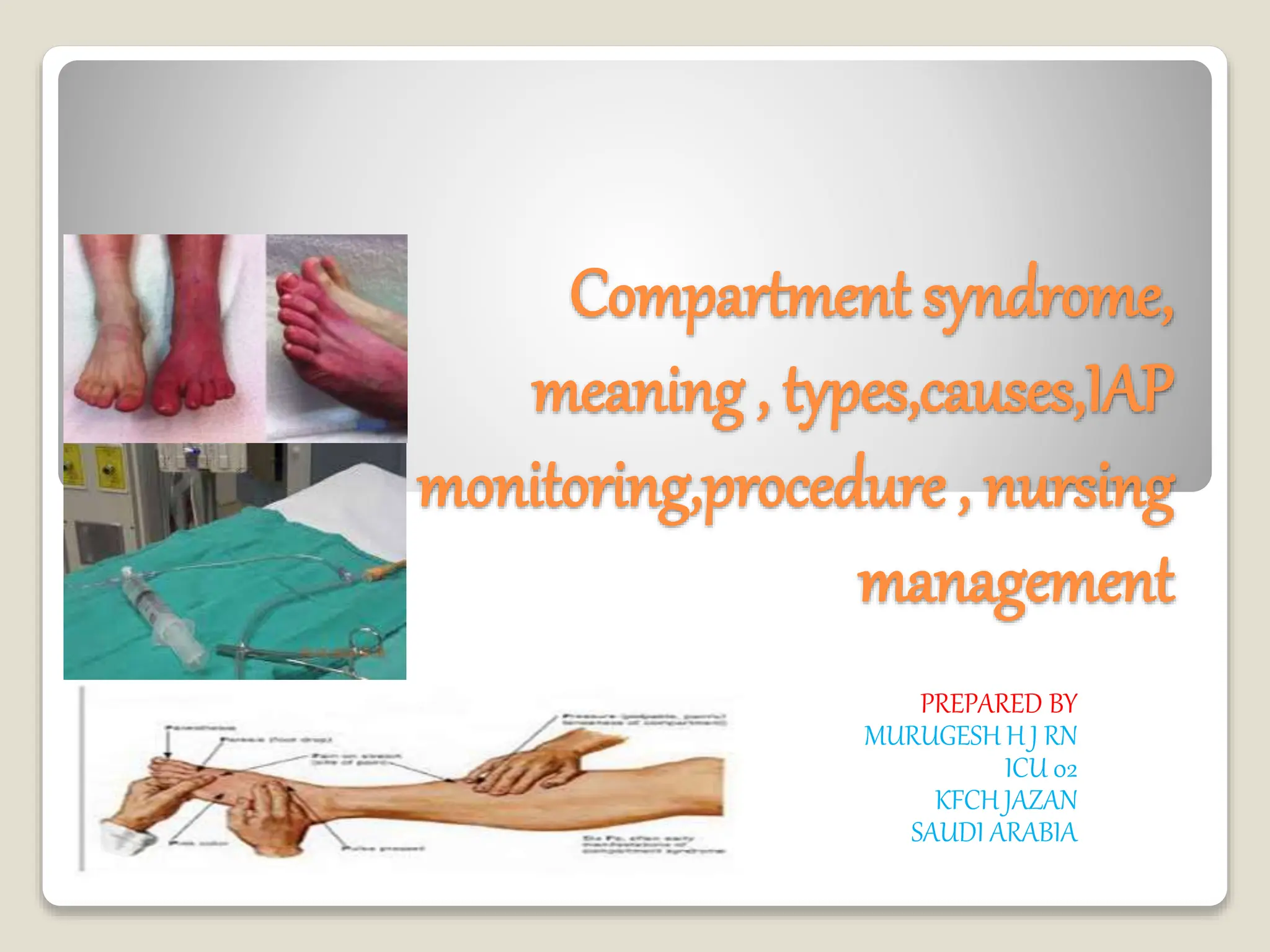 Compartment syndrome, meaning , types, causes , nursing management ...