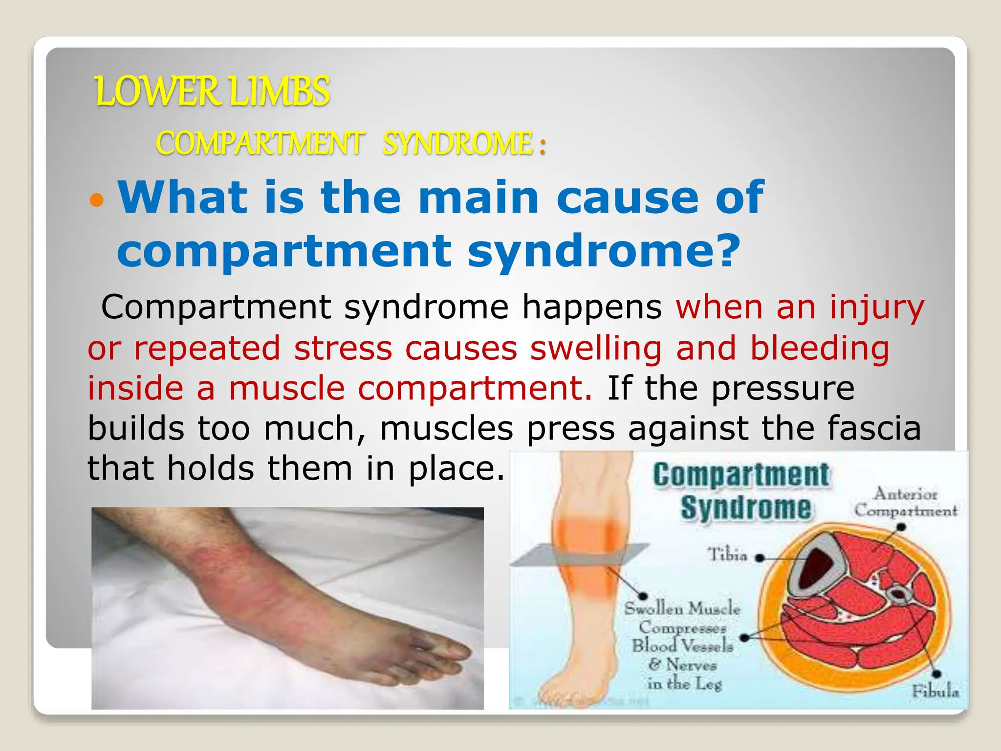 Compartment syndrome, meaning , types, causes , nursing management , murugesh (1).pptx ...