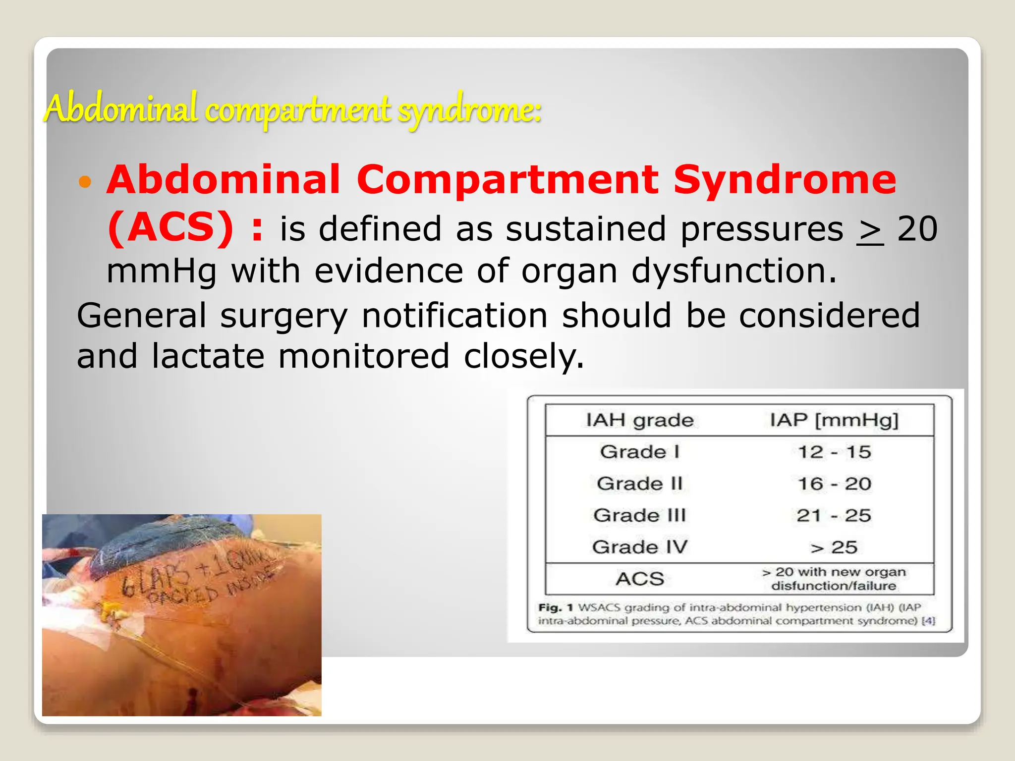 Compartment syndrome, meaning , types, causes , nursing management , murugesh (1).pptx ...