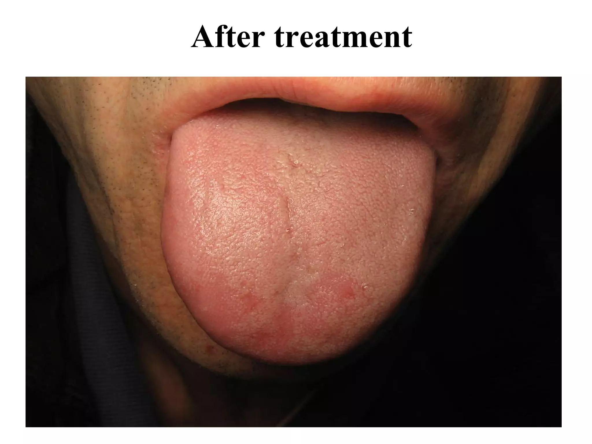 Com Findings From Tongue Diagnosis Julycorr | PPT