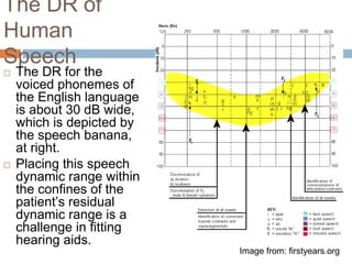 Comfort and loudness measures | PPTX