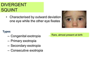 Introduction to Comitant strabismus.pptx