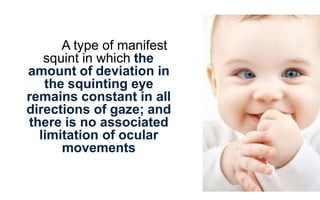 Introduction to Comitant strabismus.pptx