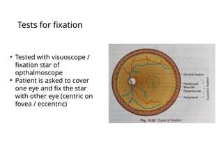 Comitant strabismus.ophthalmology.squint.pptx