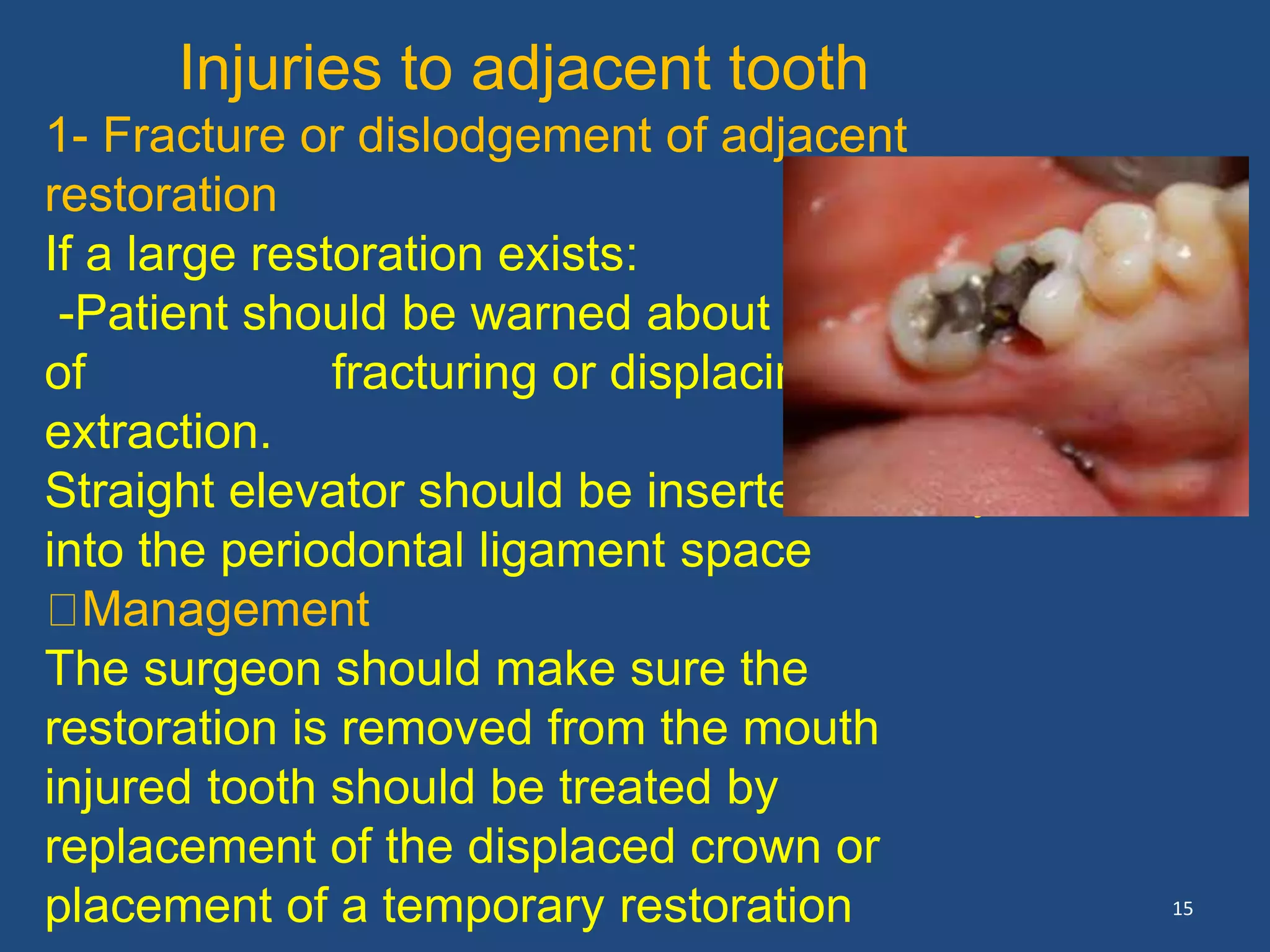 Complication of tooth extraction | PPTX