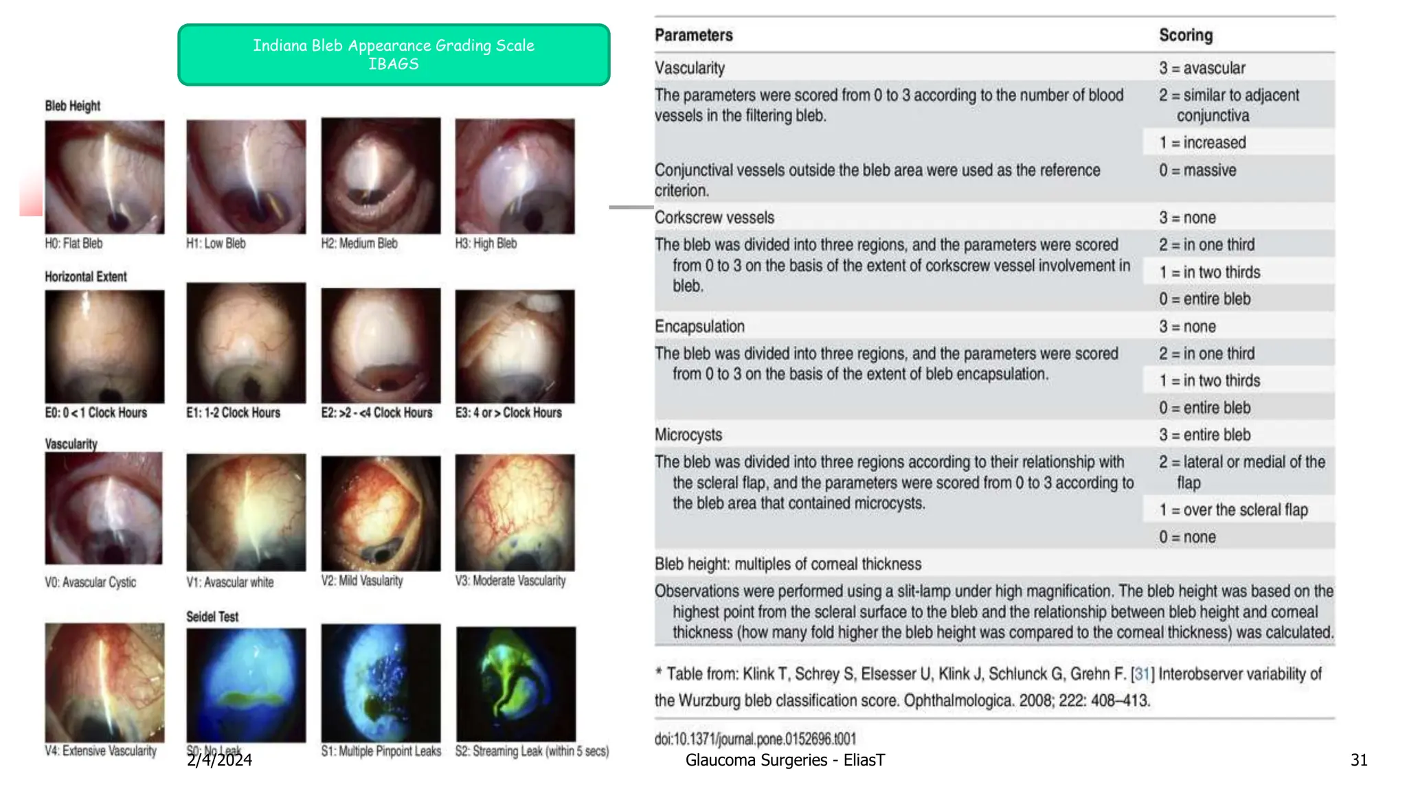 Surgical Management of Glaucoma-Elias.pptx