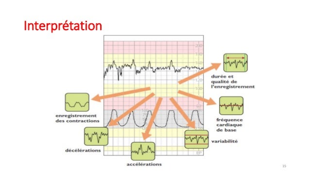 Comment utiliser le cardiotocographe, Jan Nkeck