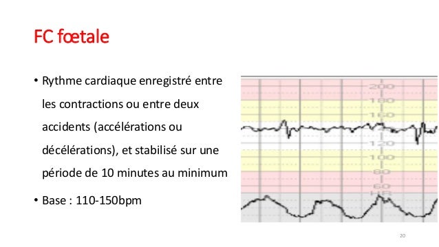 Comment utiliser le cardiotocographe, Jan Nkeck