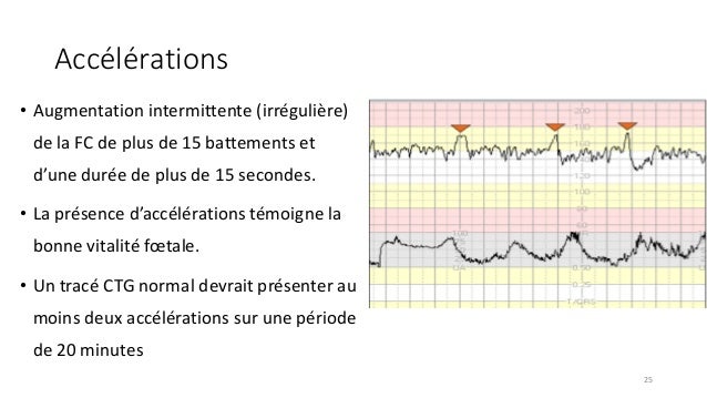 Comment utiliser le cardiotocographe, Jan Nkeck