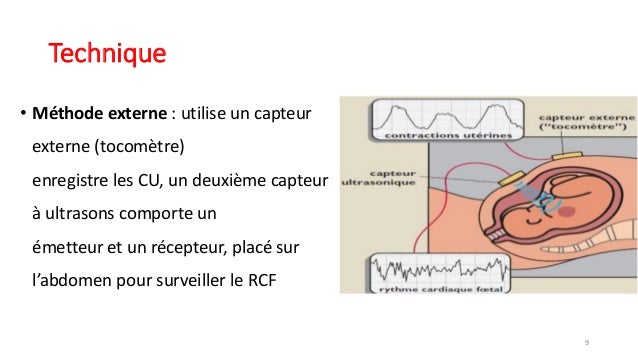 Comment utiliser le cardiotocographe, Jan Nkeck